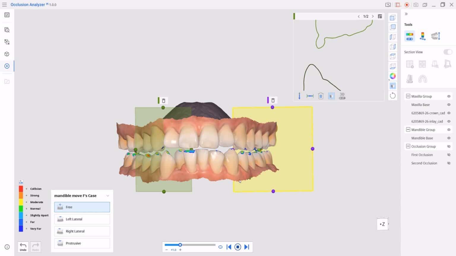 Medit Software - MEDIT Intraoral Scanners and Dental Software