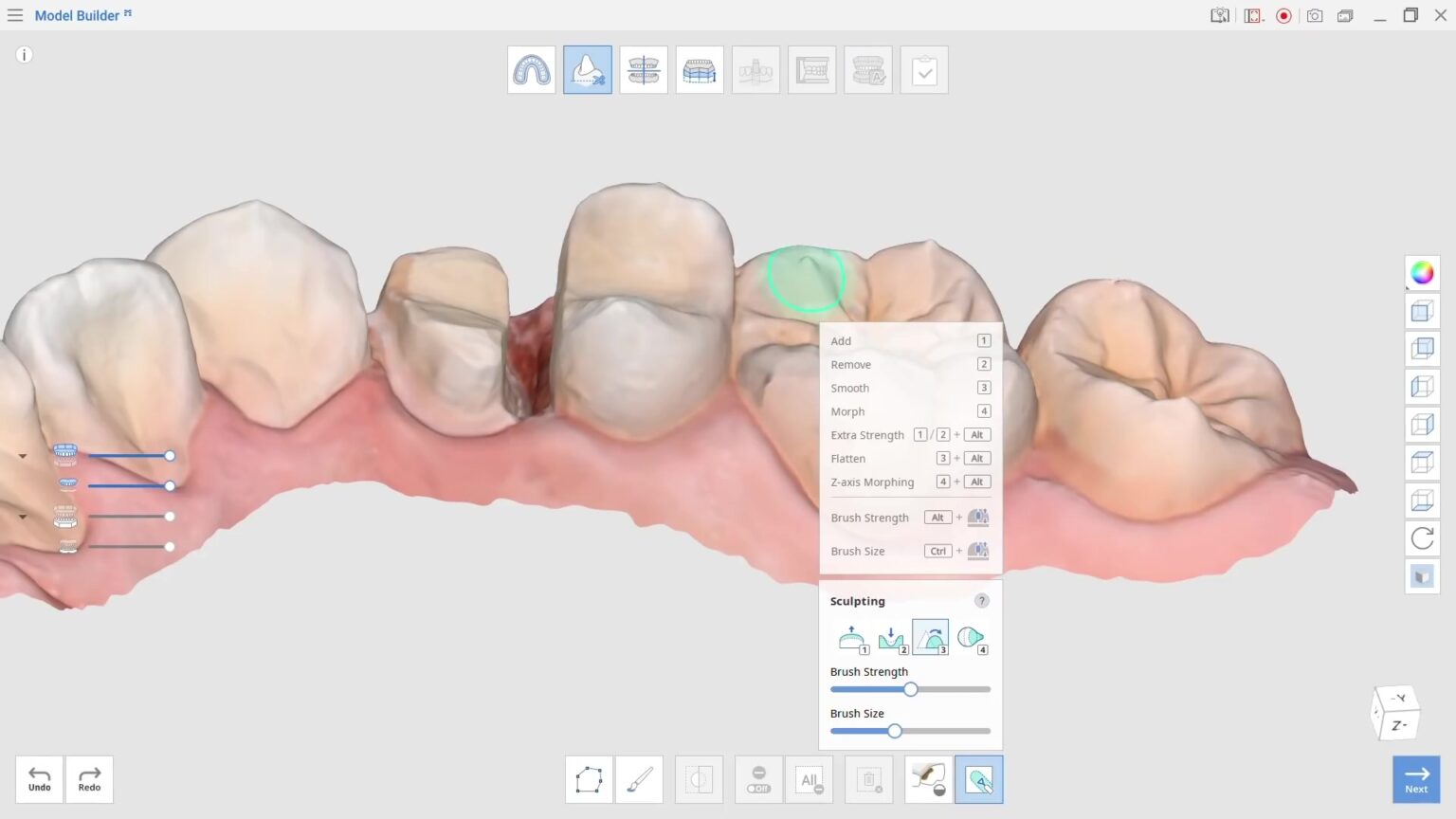 Medit Software - MEDIT Intraoral Scanners and Dental Software