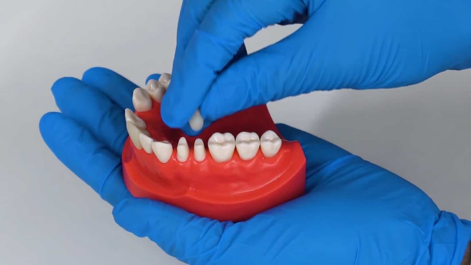 Medit Software - MEDIT Intraoral Scanners and Dental Software