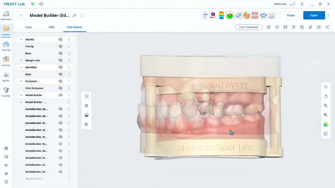 Medit Model Builder - MEDIT Intraoral Scanners and Dental Software