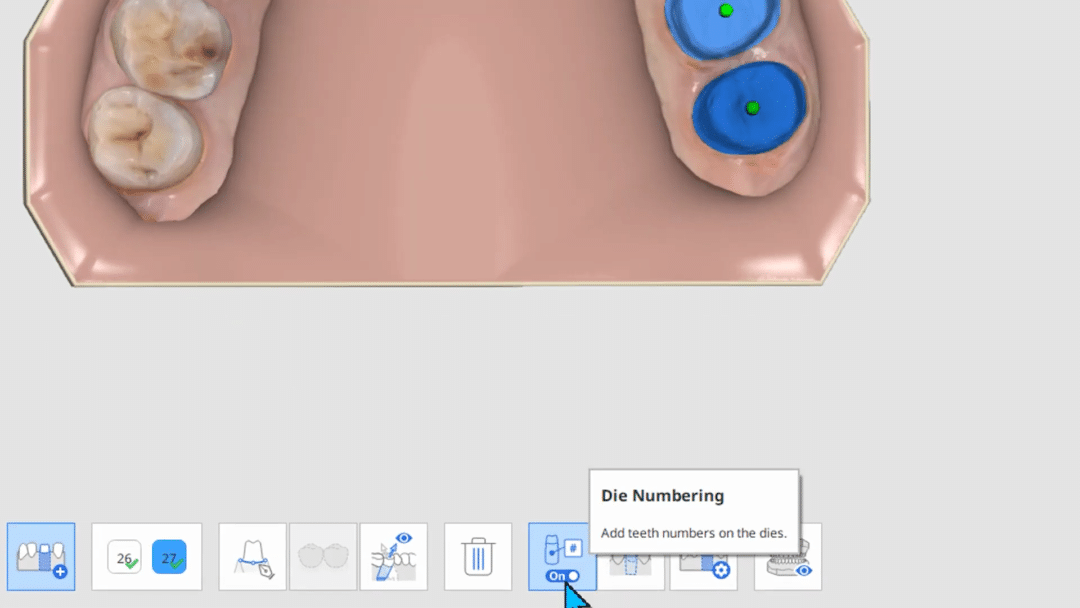 Medit Model Builder - MEDIT Intraoral Scanner and Dental Software