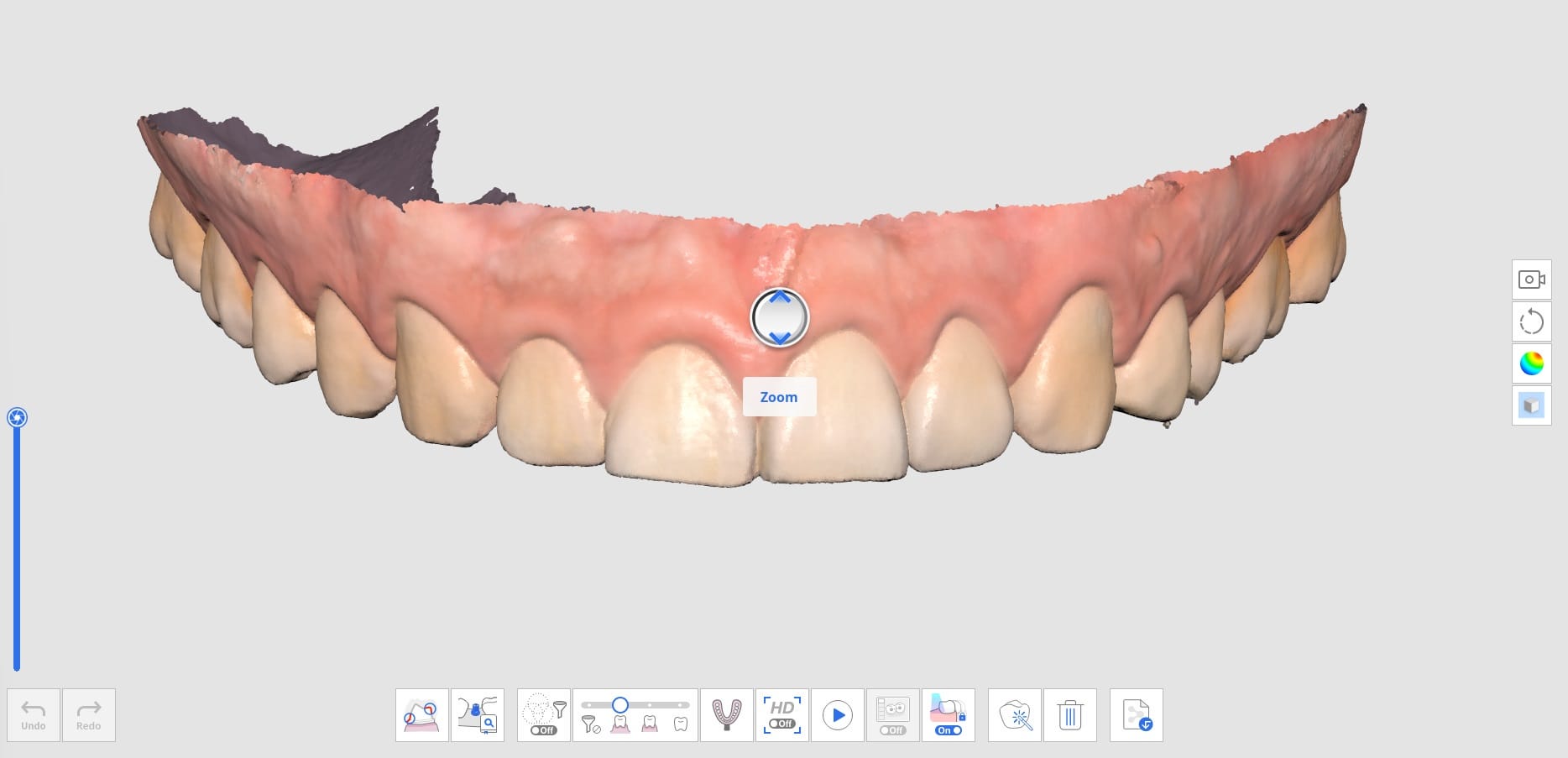 Medit Scan for Clinics - MEDIT Intraoral Scanner and Dental Software