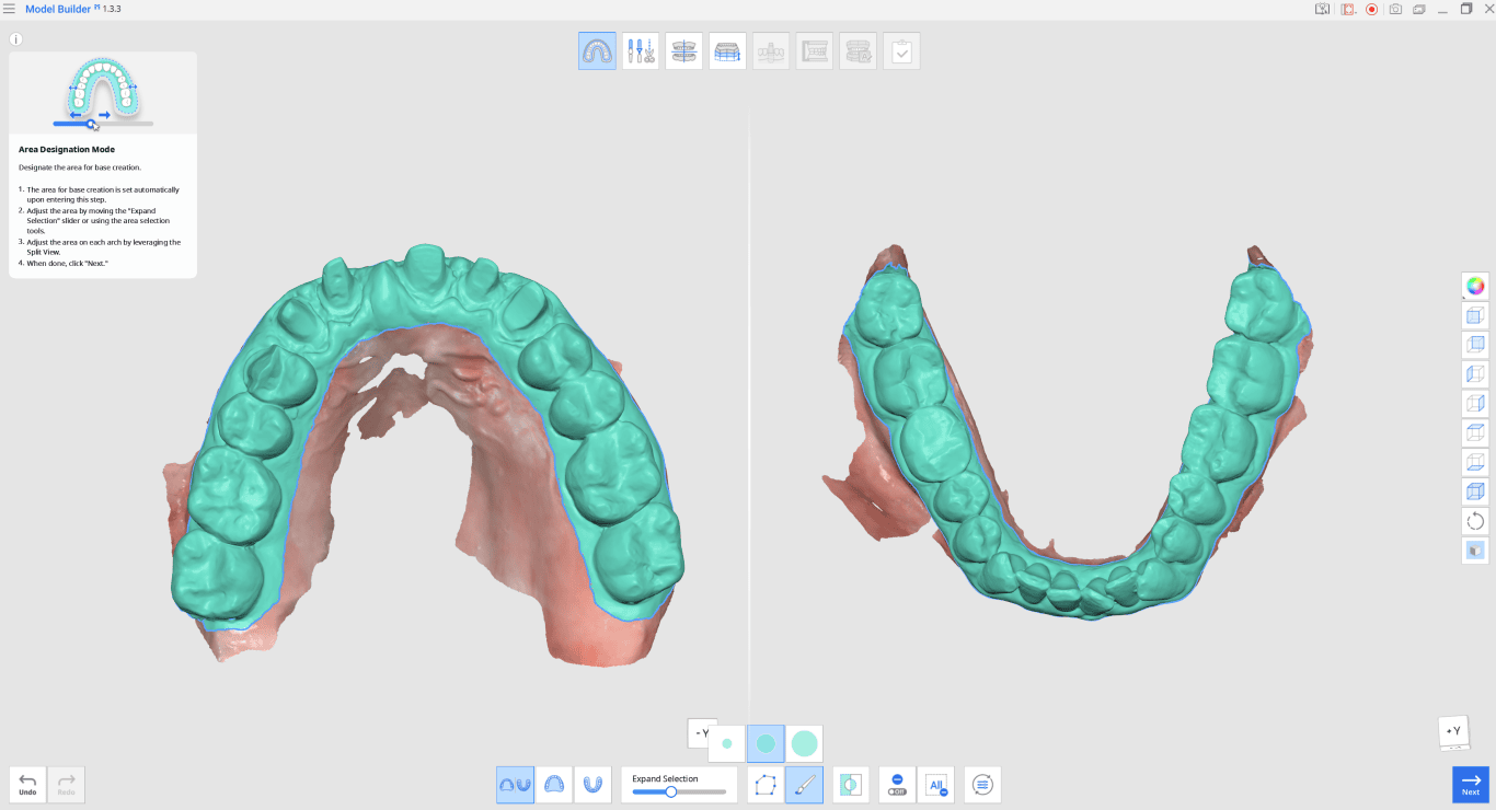 Medit Model Builder - MEDIT Intraoral Scanners and Dental Software