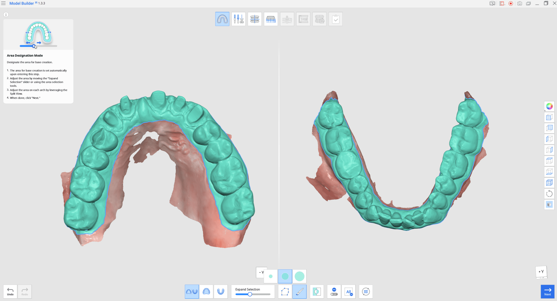 Medit Model Builder - MEDIT Intraoral Scanners and Dental Software