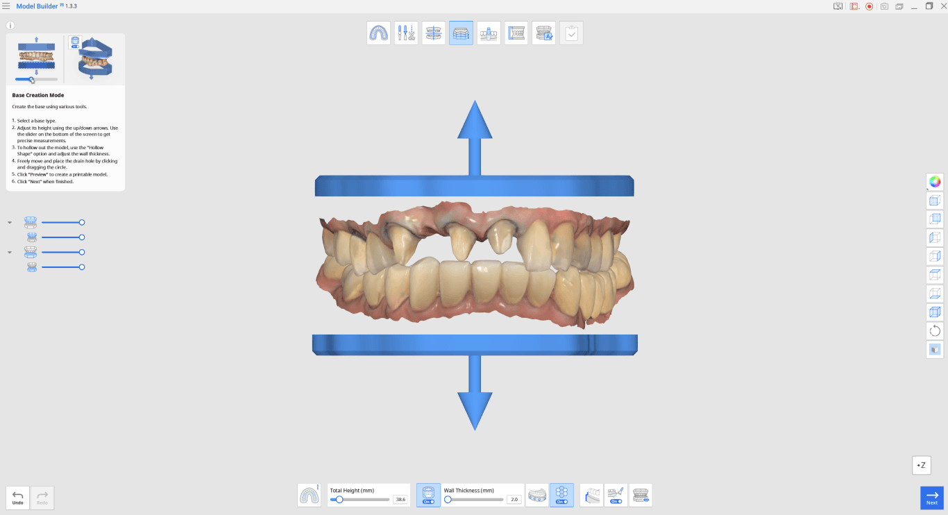 Medit Model Builder - MEDIT Intraoral Scanner and Dental Software