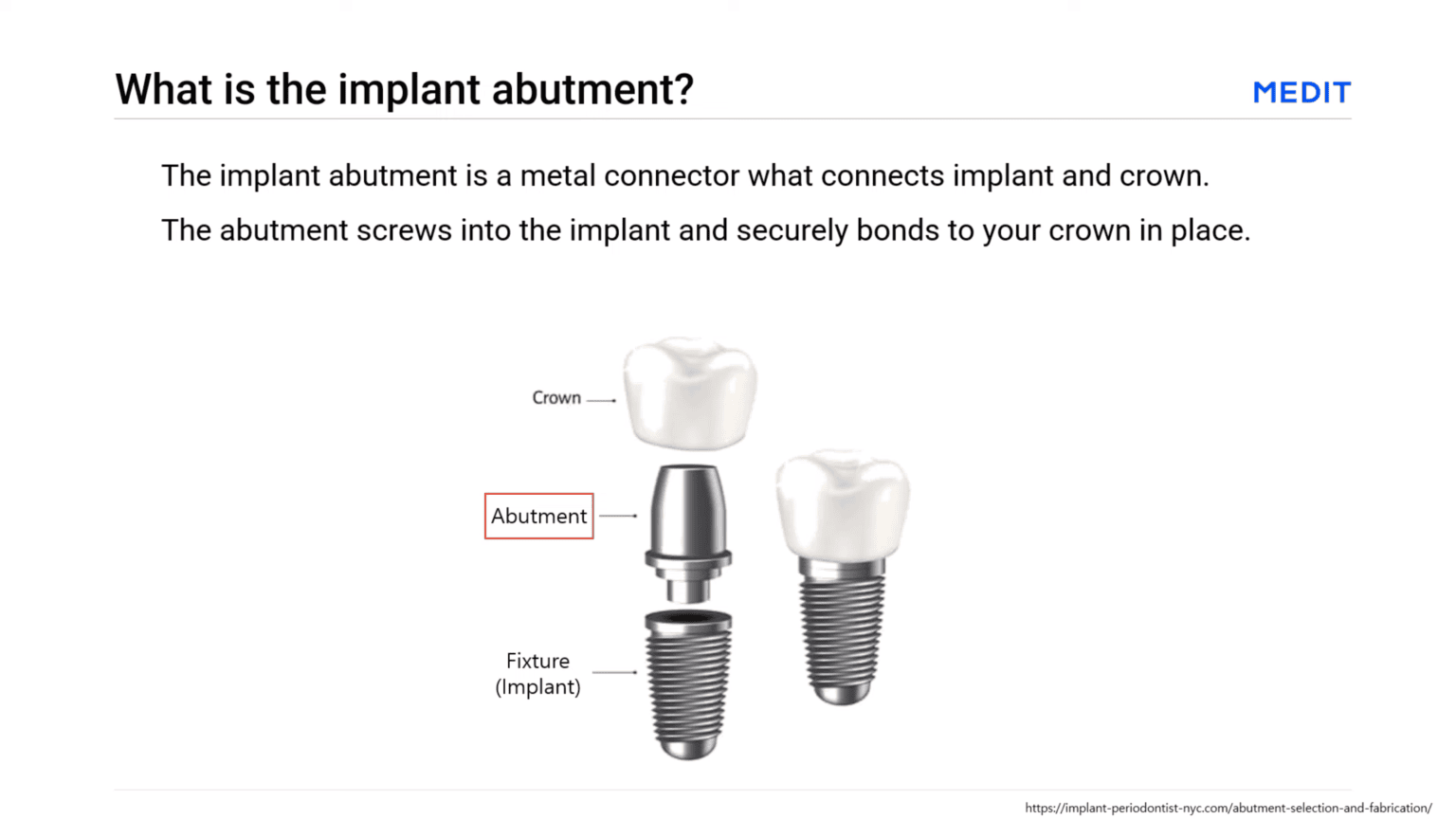 The Simplified Guide to Abutment Scanning for Dental Professionals ...