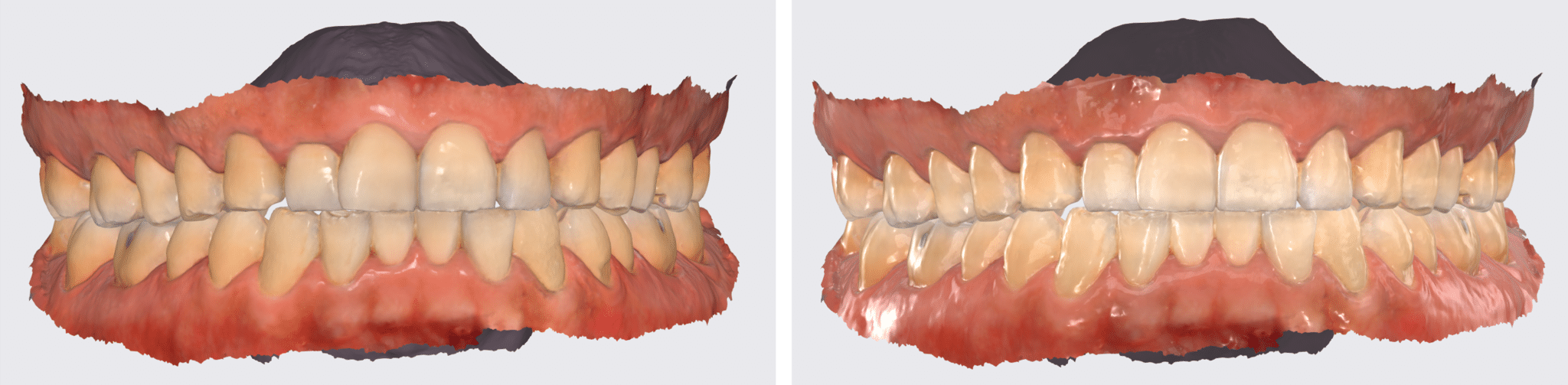 Major Software Update: Medit Link v3.4.1