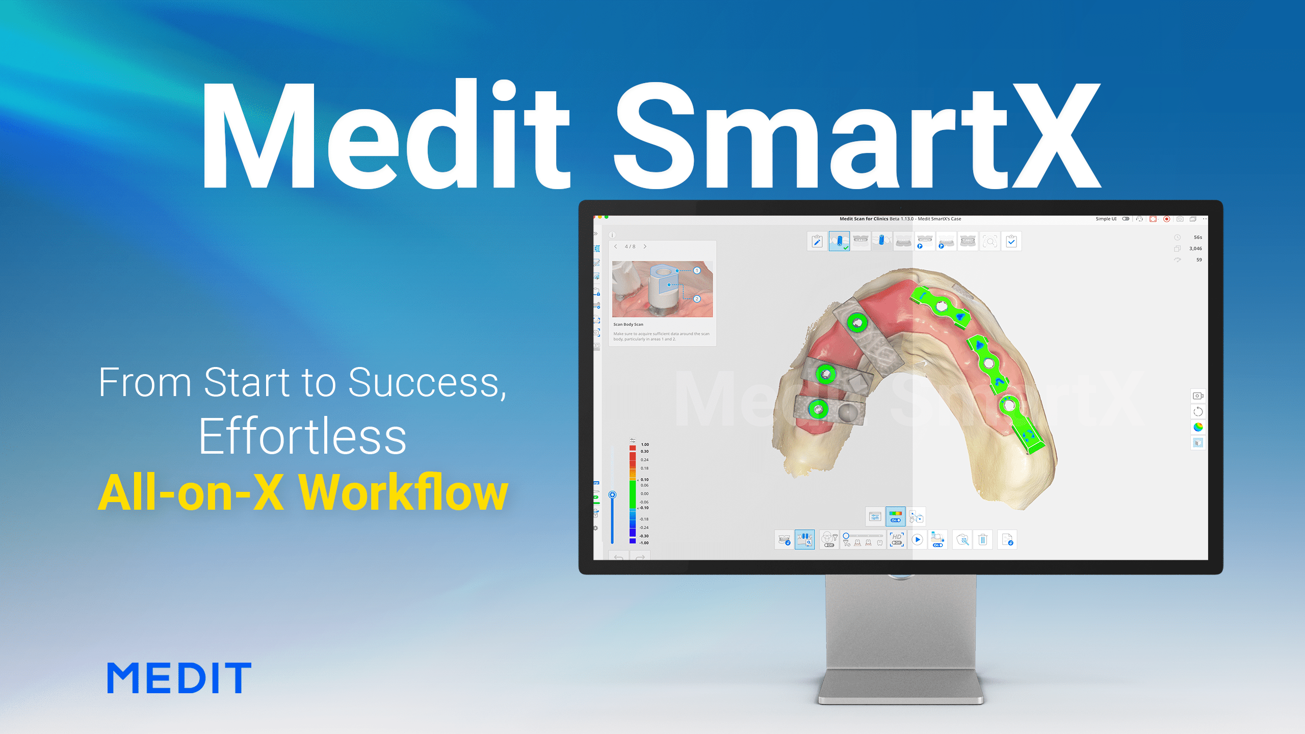 MEDIT Intraoral Scanner for Digital Dentistry
