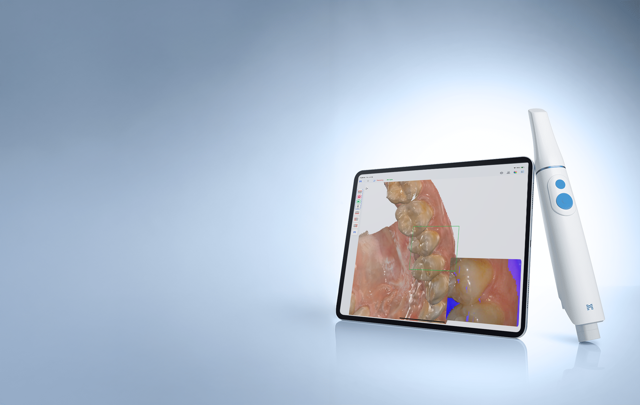 MEDIT i900 Mobility - MEDIT Intraoral Scanner and Dental Software